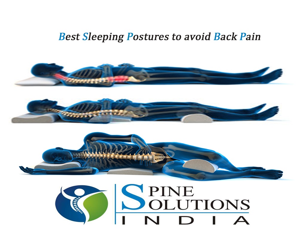 Spine Solutions India By Dr Sudeep Jain Best Sleeping Postures