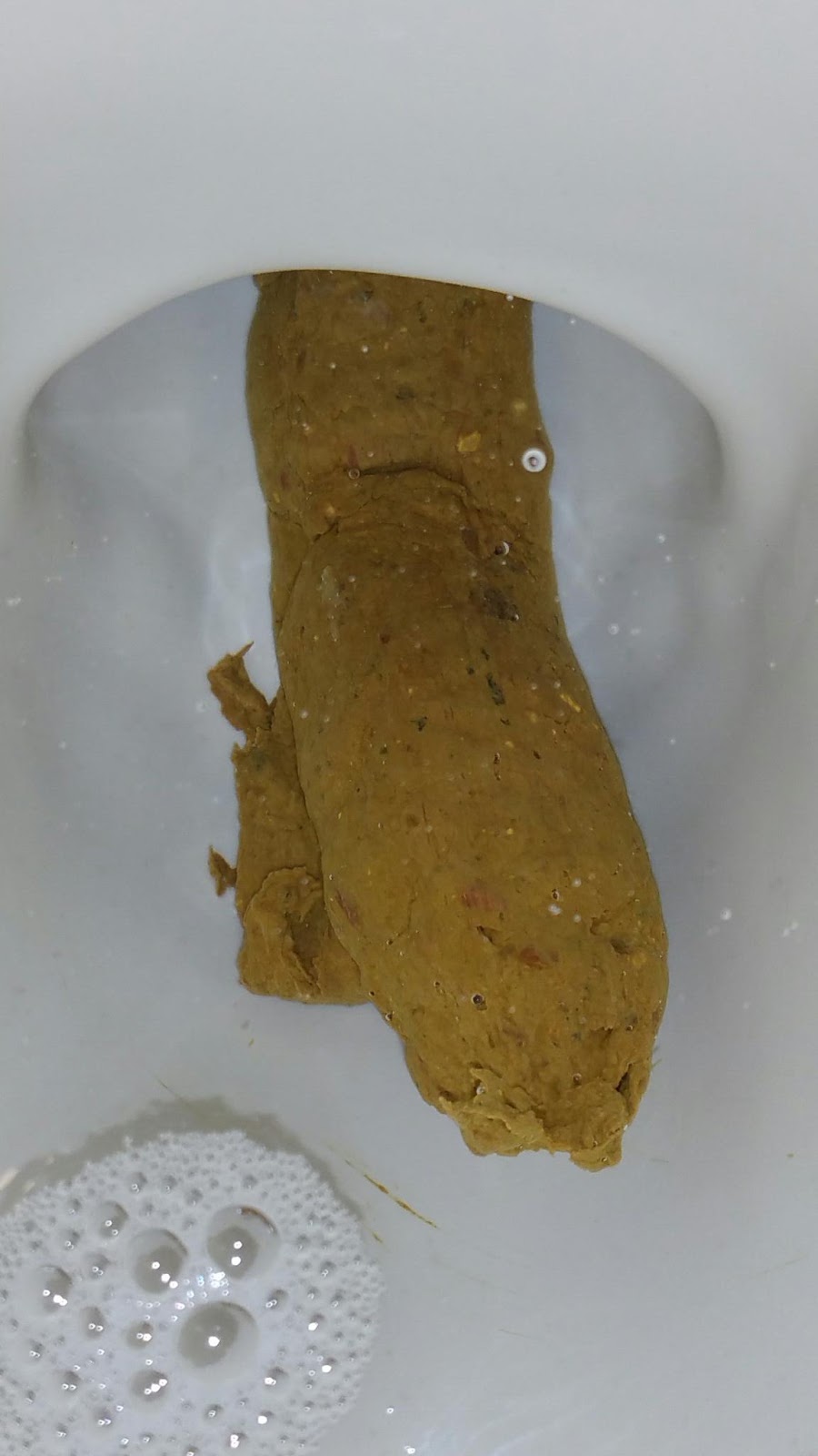 My Daily Poo: 6 Jan: Friday glaknob.