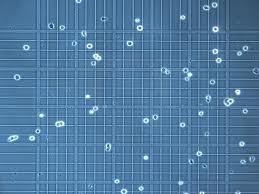 bioproess tech102: Lab 2:Measurement And Counting Of Cells Using Microscope