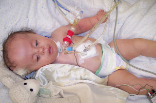 Compatible With Joy Trisomy18 10 01 2011 11 01 2011