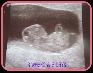 Belly Pictures: First Ultrasound at 8 weeks and 6 days