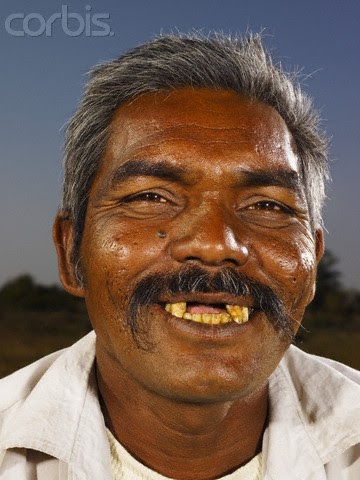 A Poor Mans Resume: Strippers Shoe Chips Indian Mans tooth