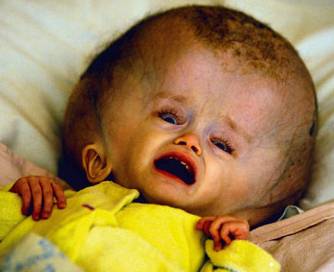 Nuclear And Radiation Disaster