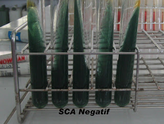 My World Fisheries: Tahap-Tahap Pengujian Escherichia coli (SNI 01-2332 ...