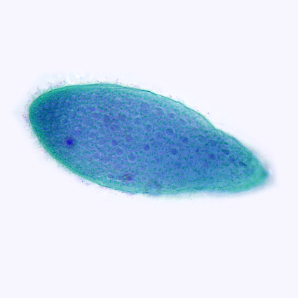MICROBIAL CLASSIFICATION: Protozoa
