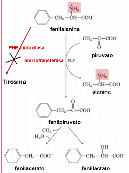Bioquímica Da Nutrição Fenilcetonúria