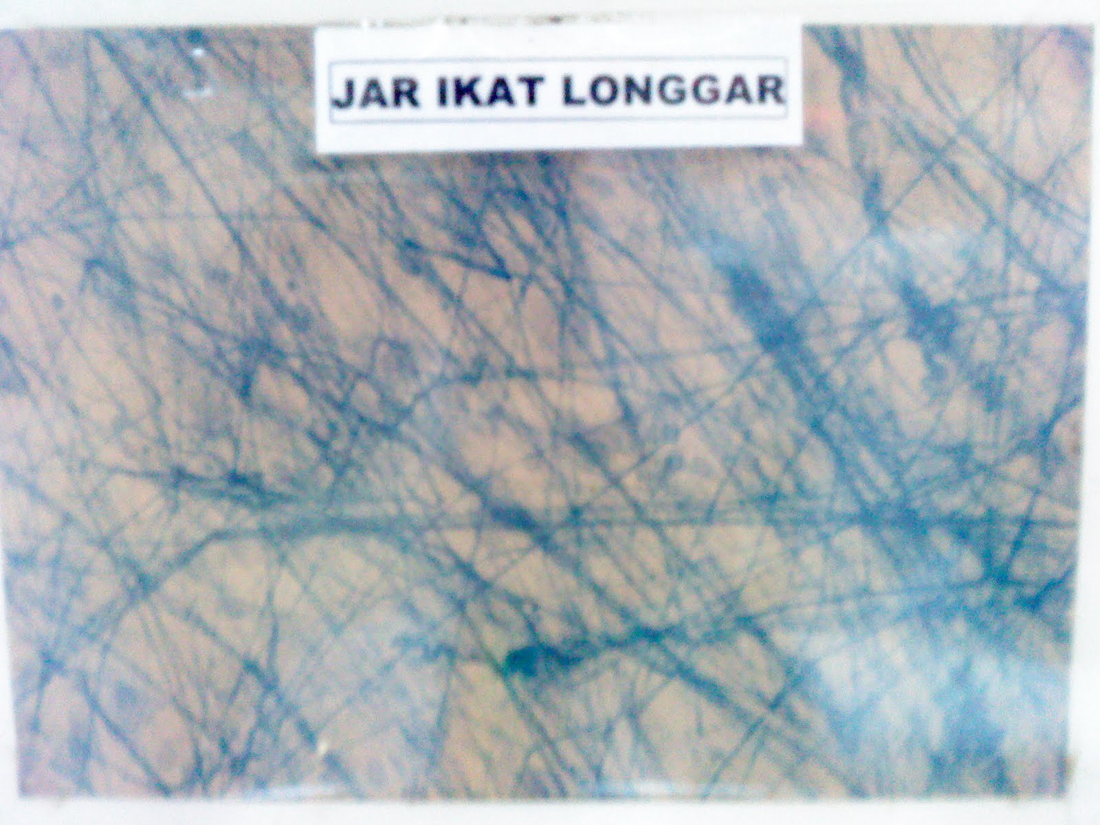 Tulang Rawan(Kartilago) | BIOLOGIPEDIA