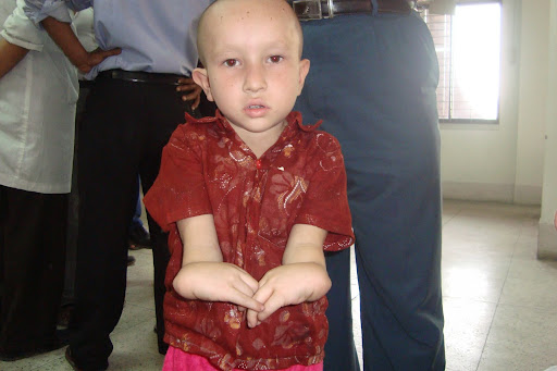 Clinical images: Congenital Radial Club Hand.