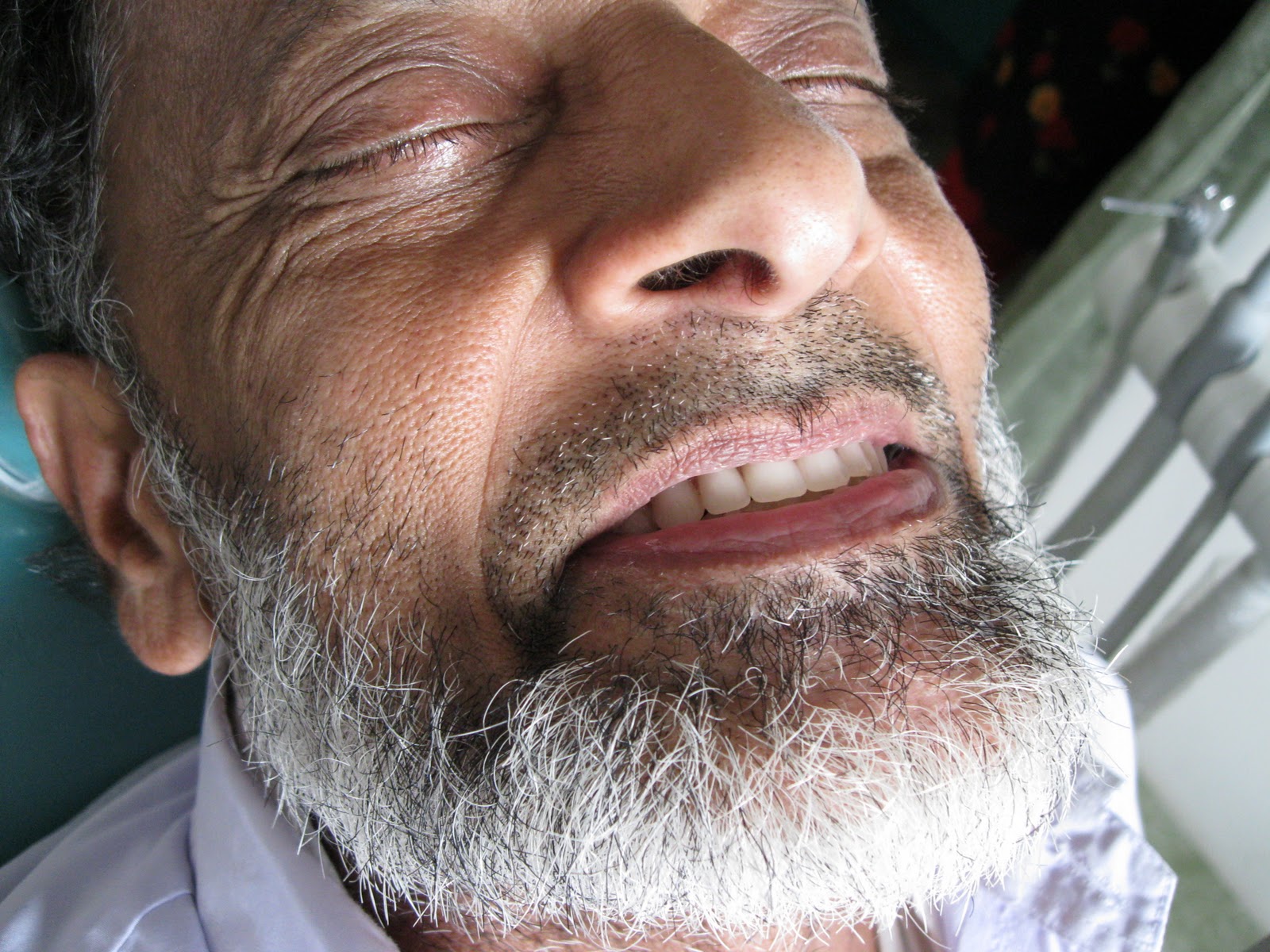 DENTO CARE DENTAL CLINICS: SUNFLEX COMPLETE DENTURE