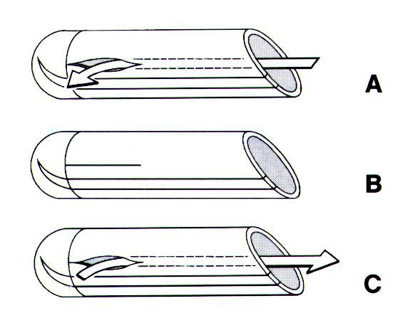 Taysir assistance الإسعاف الطبي تيسير: Cathéter de Groshong ...