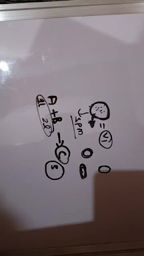 What is volume contraction?and how to know that there is a volume contrac..