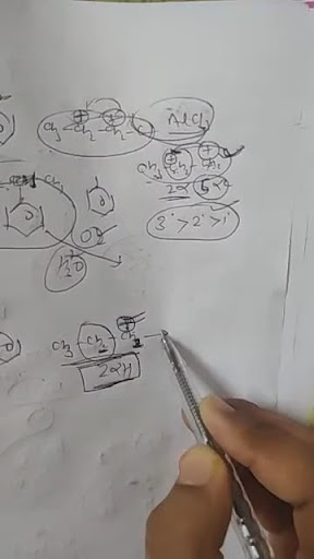 (c)(d)(NEET 2018)7. Identify the major products P,Q and R in the follo.. (c)(d)(NEET 2018)7. Identify the major products P,Q and R in the follo..