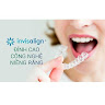 Niềng răng Invisalign Quotes | YourQuote