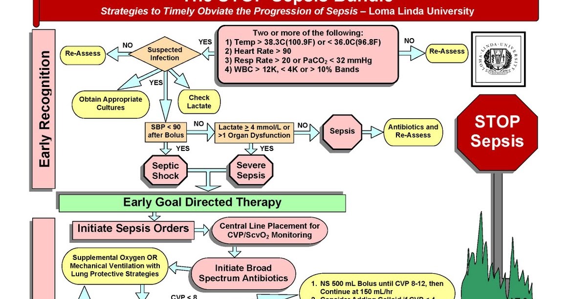 急診夜未眠: The STOP Sepsis Bundle