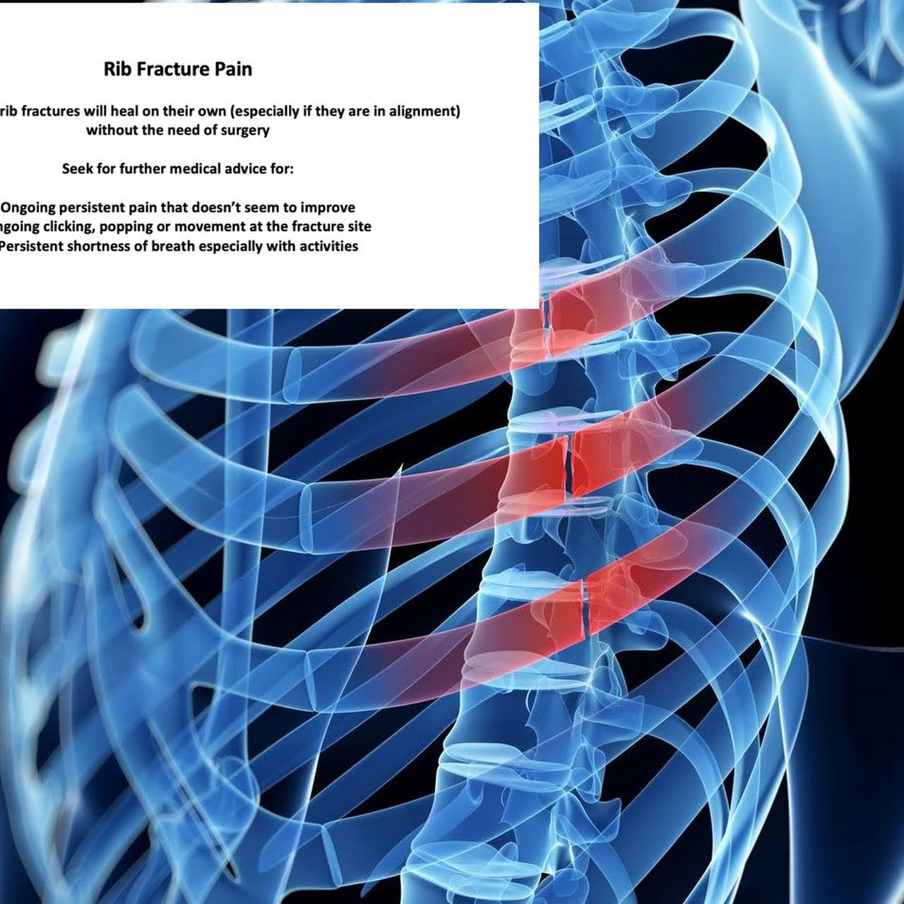 Rib Pain Clinic, Mr N Panagiotopoulos, Consultant Thoracic Surgeon ...